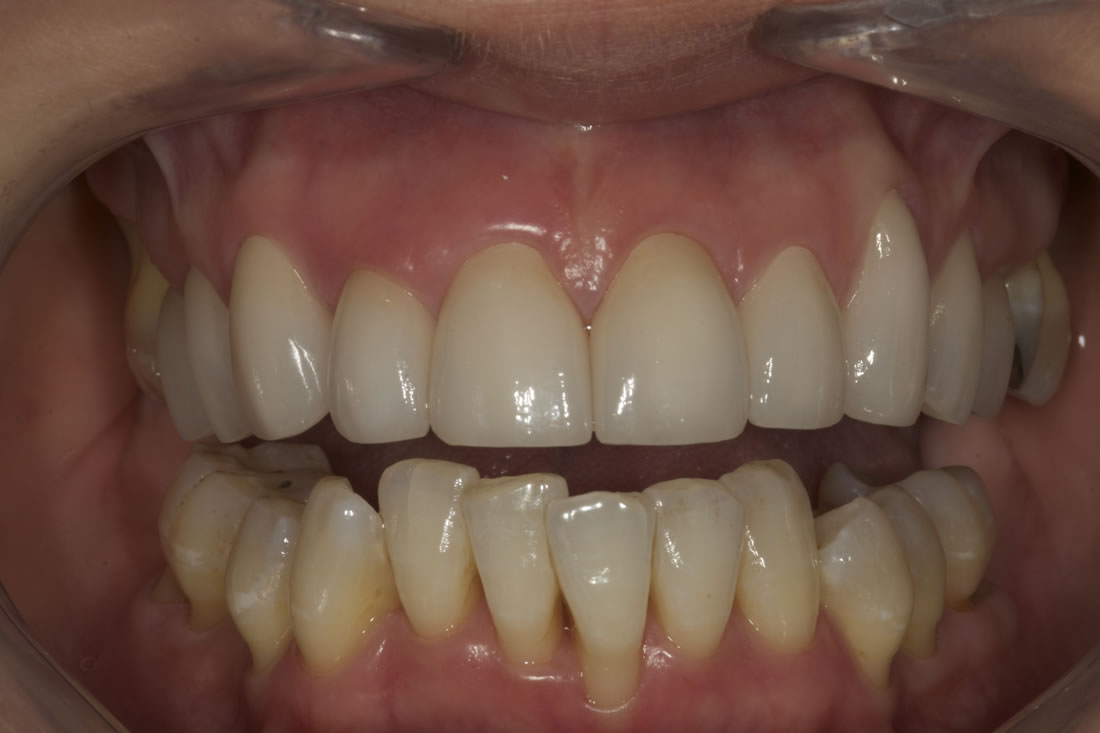 Upper Venners - Stow on the Wold Dental Practice